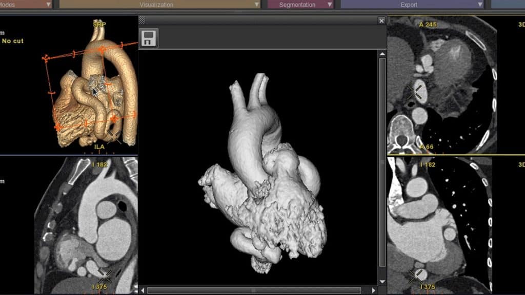 3D Modeling in Medicine: 6 Practical Ways to Use Interactive 3D Models