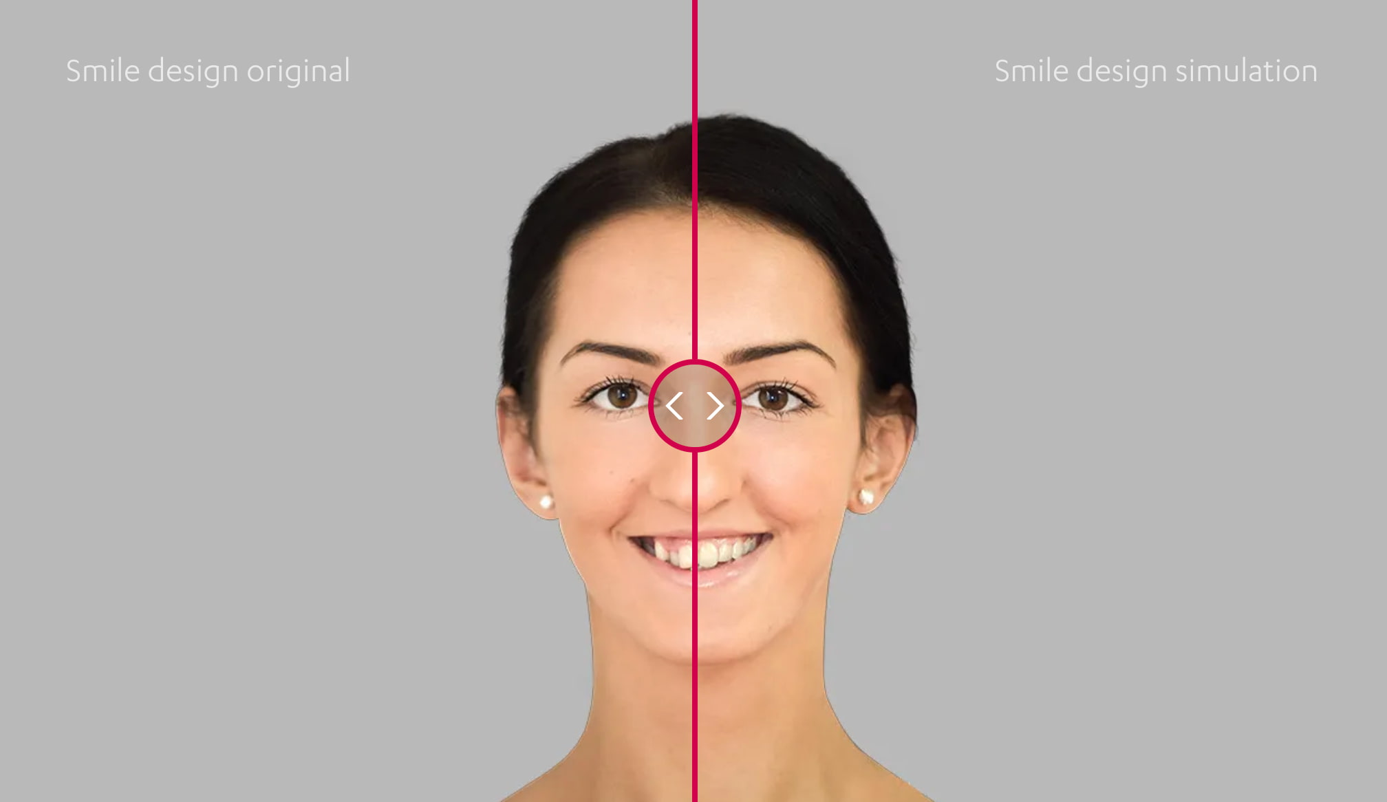 Custom AR Smile App for Dental Industry